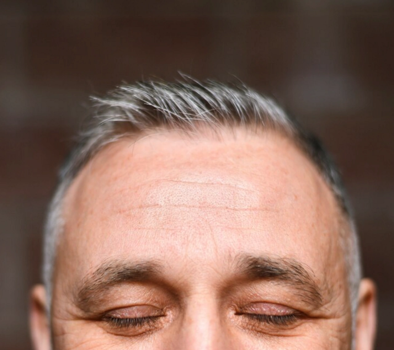 Hairline Restoration Process